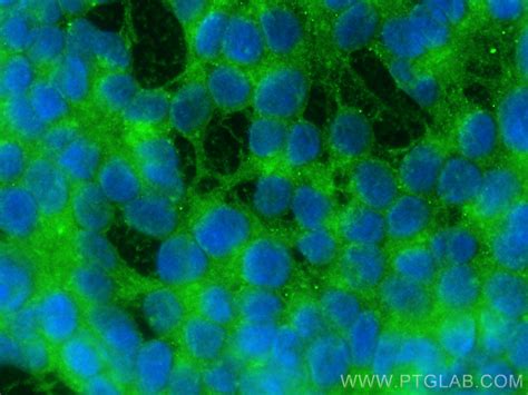 Sarm1 Antibody 28625 1 Ap Proteintech