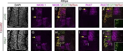 Hhip1 Noncell Autonomously Inhibits Hh Dependent Neural Patterning
