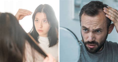 How To Stop Hair Fall Immediately With 1 Night Habit टक्कल पडण्याची