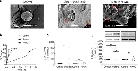 Oxygen Diffusion In HPMC A Representative Scanning Electron Download Scientific Diagram