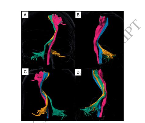 3d Rendering Of Four Tracts In Multiple Projections A Anterior B