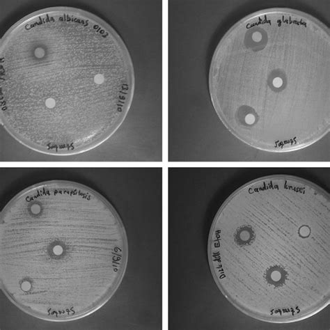Typical Agar Plates Showing The Growth Inhibition Zones By Calendula