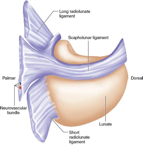 Open Reduction And Fixation Of Acute Lunate Or Perilunate Dislocation