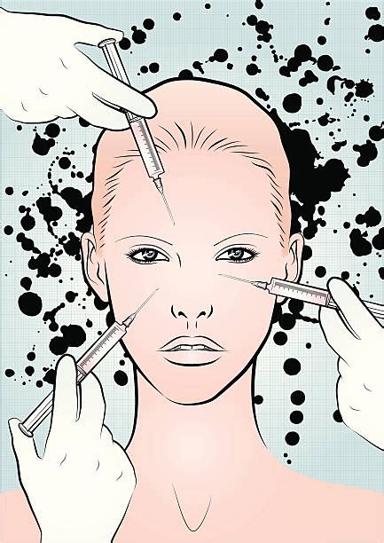 1 300 Botulinum Toxin Injection Stock Illustrations Royalty Free