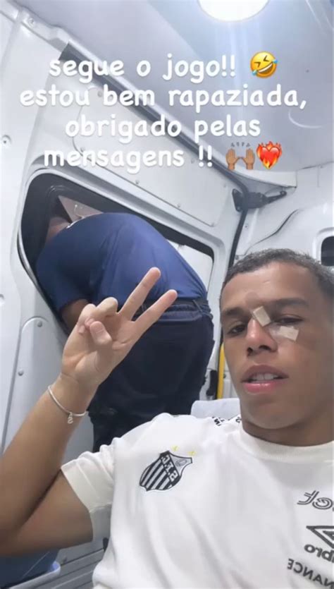 Sandry é Operado Após Sofrer Cotovelada No Jogo Entre Santos E Portuguesa Lance