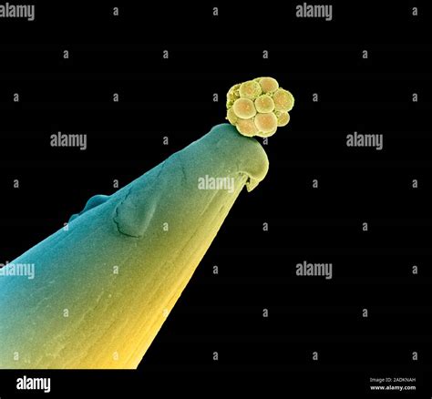 Human Embryo Coloured Scanning Electron Micrograph Sem Of A Human