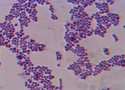 Pathogen Detection Service At 2500 Sample In Salem ID 6650770997