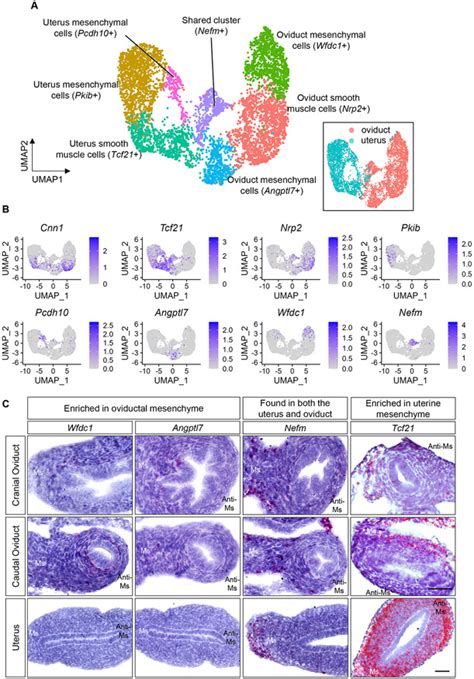 Single Cell Transcriptomic Profiling Of The Neonatal Oviduct And Uterus