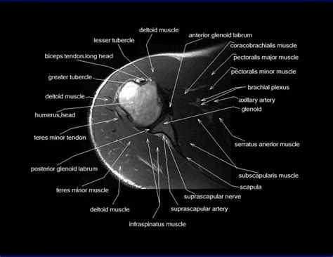 Axial Shoulder Anatomy Imaging Anatomy