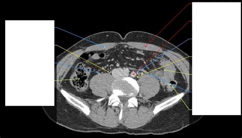 Pelvis 2 Diagram Quizlet