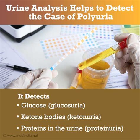 Polyuria Causes Symptoms Diagnosis Treatment And Prevention