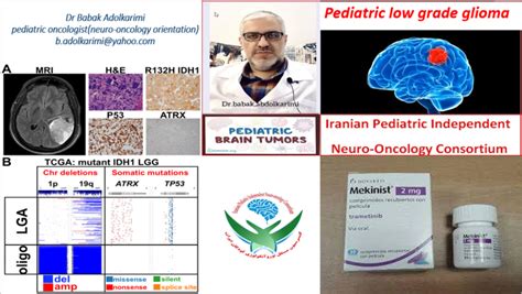 Pdf Pediatric Low Grade Glioma Brain Tumor