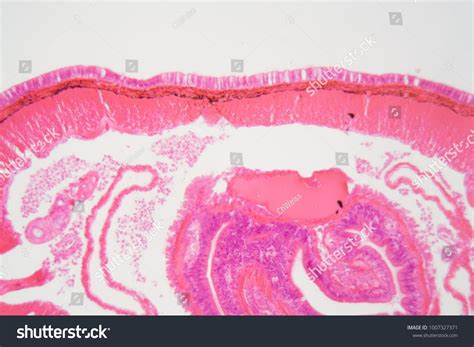 Earthworm Cross Section Under Microscope