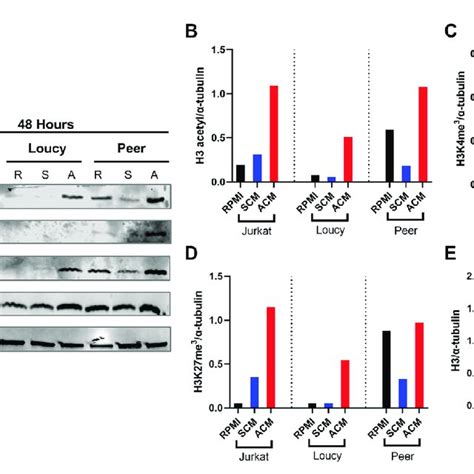 Adipocyte Secretome Induces Cell Progression In Human T ALL Cells With
