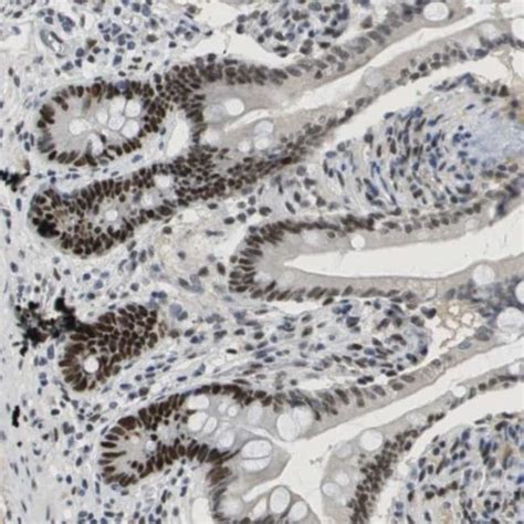 Smarcad1 Antibody Novus Biologicals™ 25 μl Unlabeled Fisher Scientific