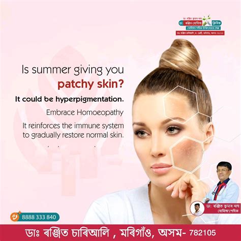 Dr Ranjit Nath On Linkedin Patchy Skin Hyperpigmentation