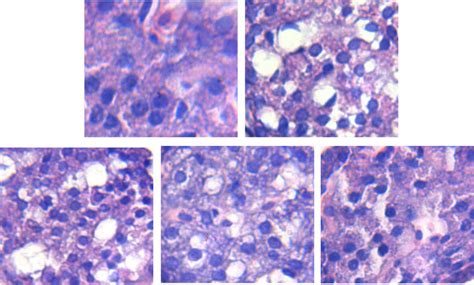 Representative Photomicrographs At 100 Magnification Of The Liver