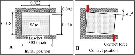 Initial And Contact Positions Of The Archwire Put Into The Bracket The Download Scientific