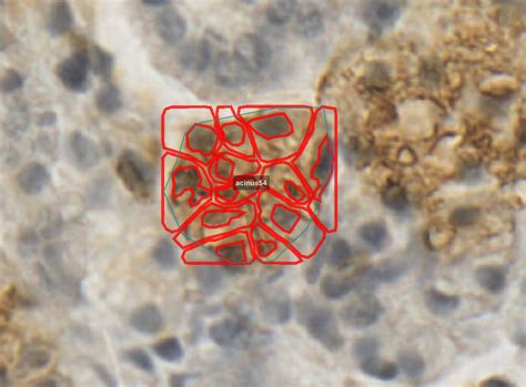Cell Nucleus Expansion Only Up To Parent Annotation Boundary Image Analysis Image Sc Forum