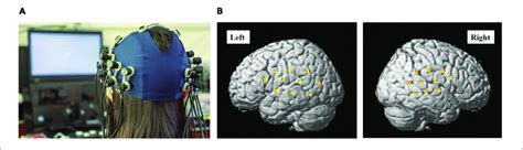 A The Photograph Of The Optode Array Placed On The Head Of One Of Download Scientific