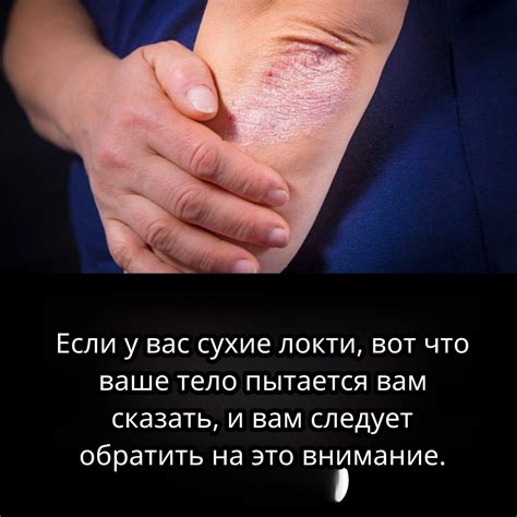 Обними Обними Added A New Photo