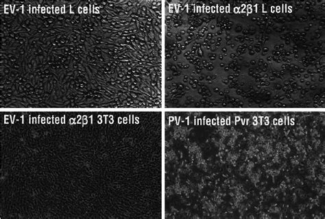 Development Of Cytopathic Effect Cpe After Virus Infection Cells
