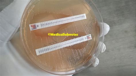 E Epsilometer Test Introduction Principle Purpose Procedure