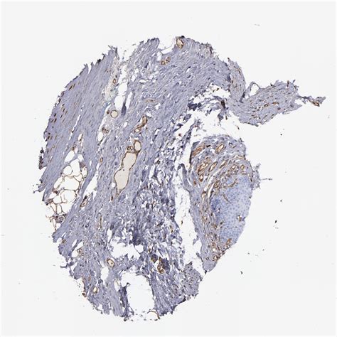Tissue Expression Of Vim Staining In Nasopharynx The Human Protein
