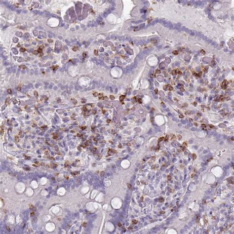 Mouse Monoclonal Anti Ptprc Antibody Buy For Research Highly