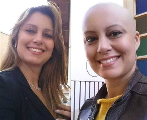 Before After Shaved Heads Pics Shaved Hair Women Shaved Head Women