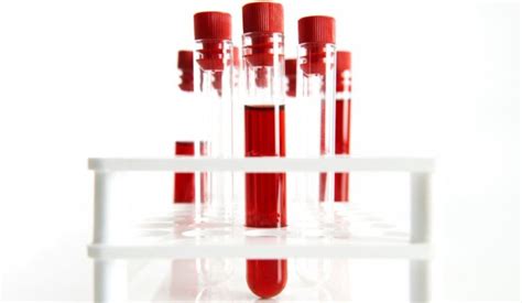 Otoscopia Definición Utilidades Y Proceso De Realización