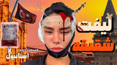 ولاگ کامل جراحی لیفت شقيقه ی من در استانبول، از روز اول عمل تا باز کردن بخیه ها 🇹🇷 ️🩸💉 Youtube
