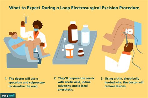 The Facts About Pregnancy After A Leep Procedure