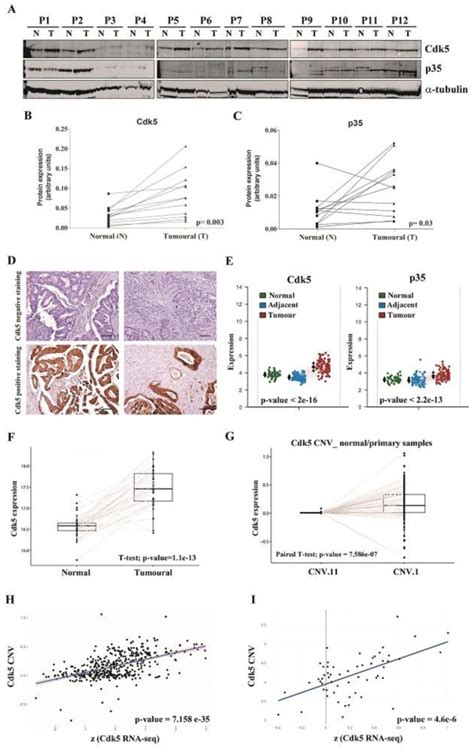 Tumor Expression Of Cyclin Dependent Kinase 5 Cdk5 Is A Prognostic
