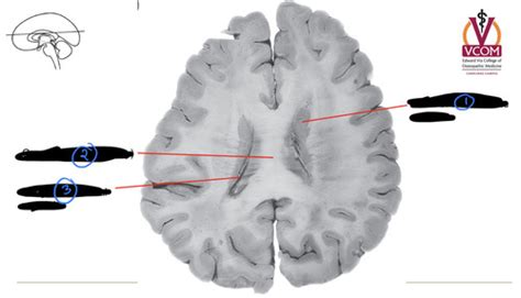 Practical 1 Cerebrum And Cerebellum Cross Sections Flashcards Quizlet