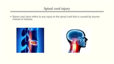 Spinal Fracture Pptx