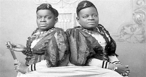 Millie Mccoy And Christine Mccoy The Carolina Twins Kentake Page