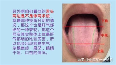 送你一盒中成药重安神轻疏肝睡得香 知乎