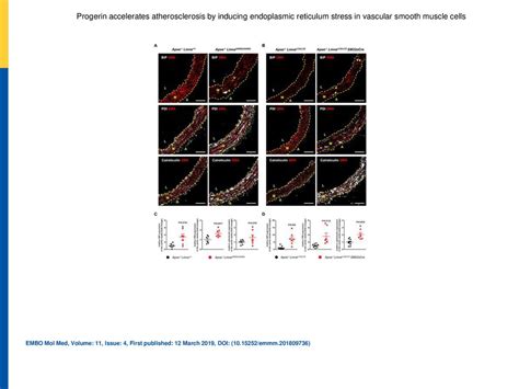 Progerin Accelerates Atherosclerosis By Inducing Endoplasmic Reticulum