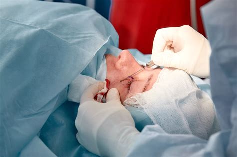 Comprehensive Guide To Trabeculectomy World Eye Care Foundation