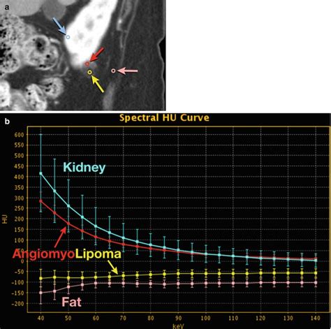 Dual Energy And Spectral Energy Computed Tomography Oncological Body