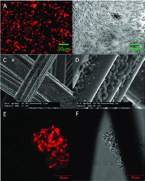 A Confocal Microscopy Image Excitation At 488 Nm Showing Successful