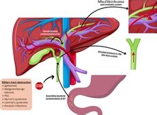 Annals Of Medicine And Surgery