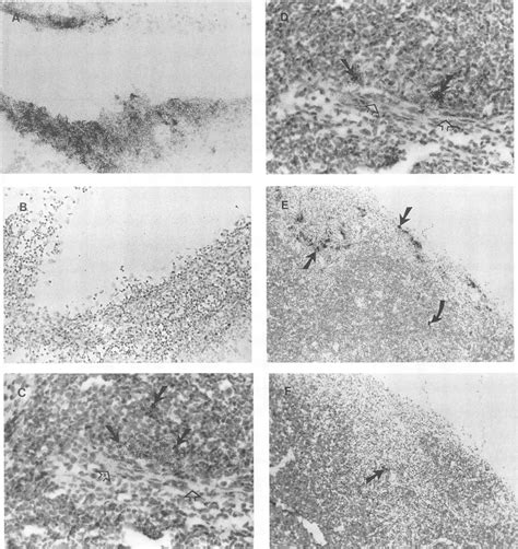 Expression Of Lcmv Np Rna And Ifn A Mrna In The Brains Spleens And