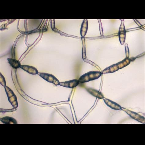 Allomyces Arbuscula Living Tube Carolina Biological Supply