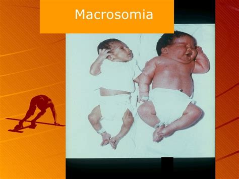 Gestational Diabetes