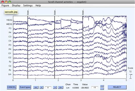 Artifact Rejection In Continuous Data Ucdavis Erplab Github Wiki