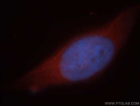 Hepacam Antibody 18177 1 Ap Proteintech 武汉三鹰生物技术有限公司