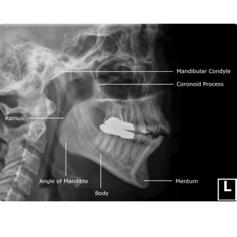 Rad Anatomy Quiz Xray Prep