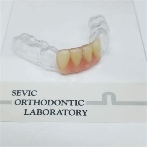Essix Retainer With Pontics